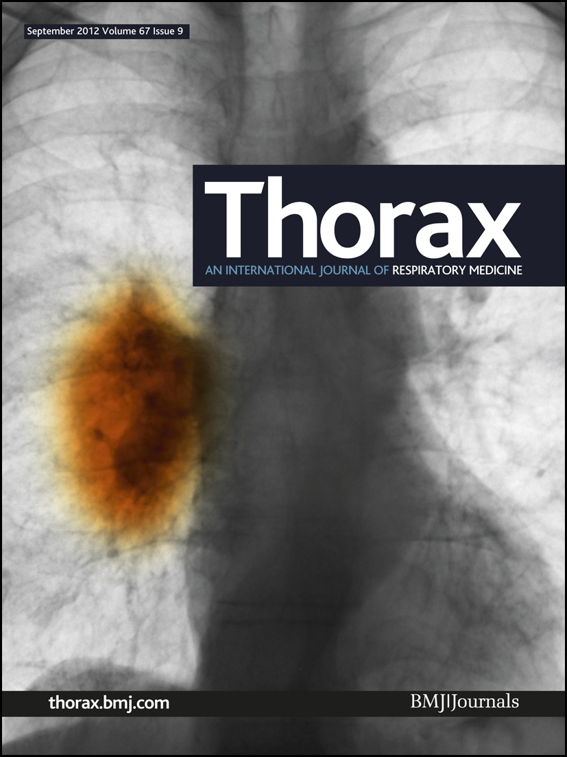The development and validation of the King's Brief Interstitial Lung ...
